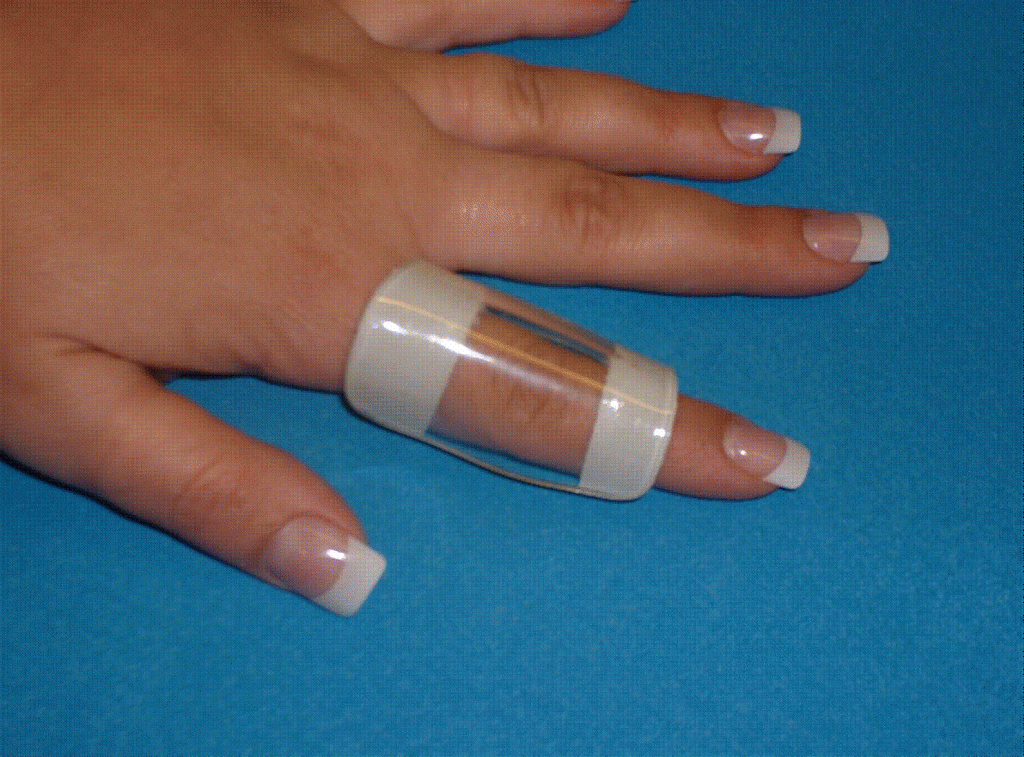 Bewegungsschiene nach Maß – Orthopädie Technik Zentrum