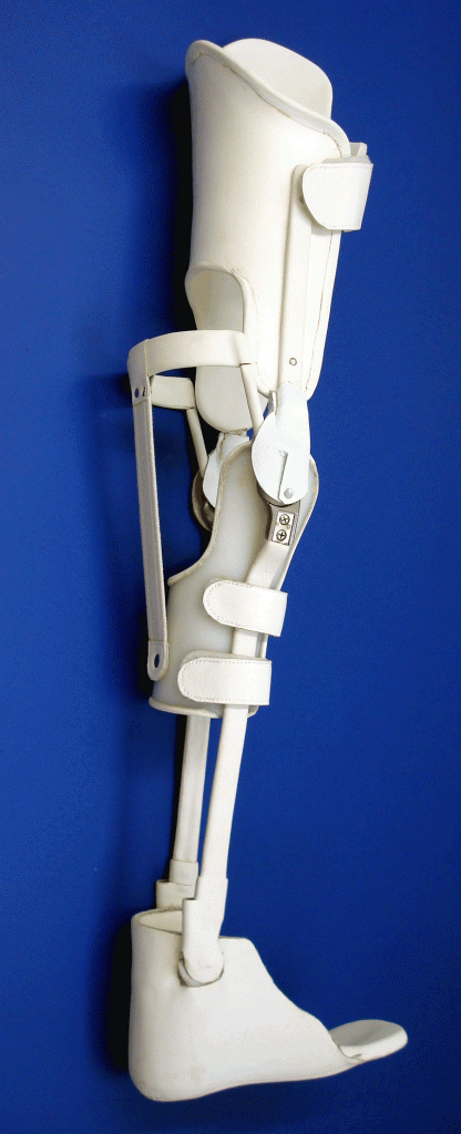 OS-Stütz-Führungs-Entlastungs Apparat aus Kunststoff/Carbon – Orthopädie Technik Zentrum