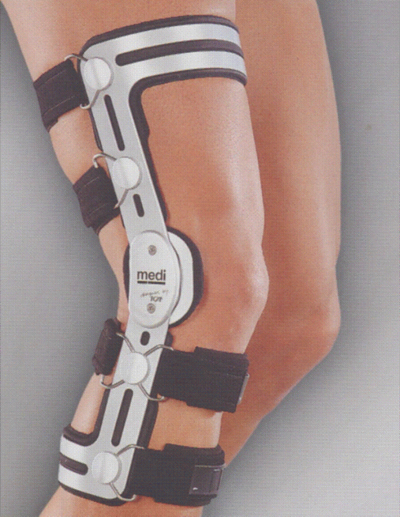 Knieschiene in Hartrahmenbauweise (z.B. M.4®) – Orthopädie Technik Zentrum